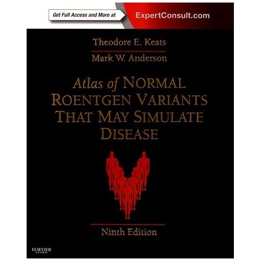 Atlas Of Normal Roentgen Variants That May Simulate Disease | Rakuten