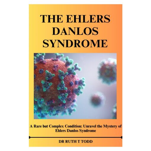 THE EHLERS DANLOS SYNDROME ( Full Colored): A Rare but Complex ...