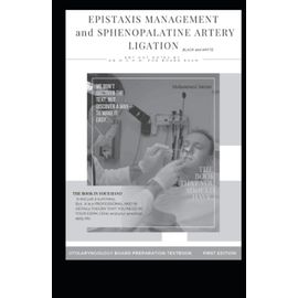 Epistaxis Management And Sphenopalatine Artery Ligation Black And White ...