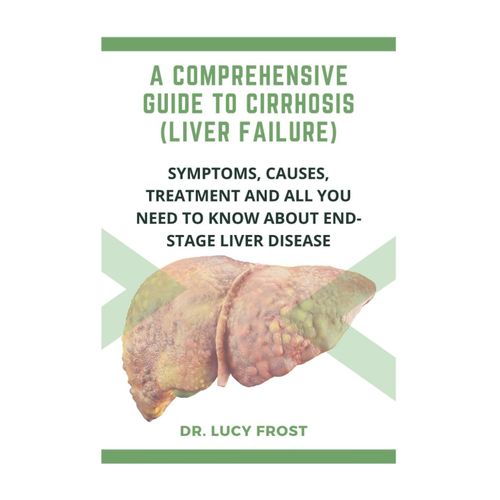 A Comprehensive Guide to Cirrhosis (Liver Failure): Symptoms, Causes ...