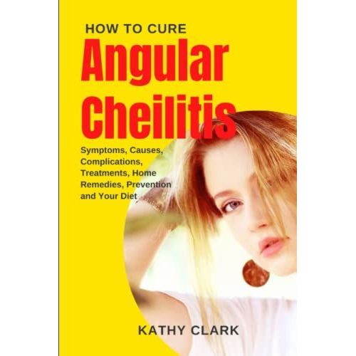 Angular Cheilitis: How To Cure Angular Cheilitis, Symptoms, Causes ...