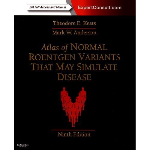 Atlas Of Normal Roentgen Variants That May Simulate Disease | Rakuten