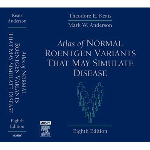 Atlas Of Normal Roentgen Variants That May Simulate Disease | Rakuten