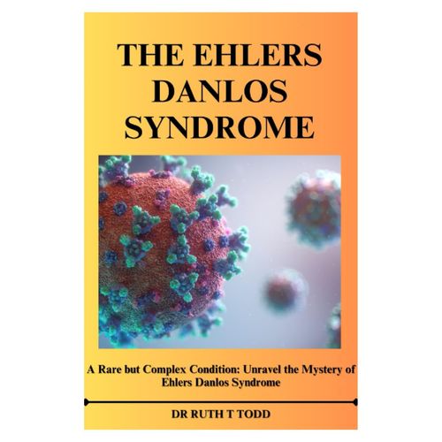 THE EHLERS DANLOS SYNDROME ( Full Colored): A Rare but Complex ...