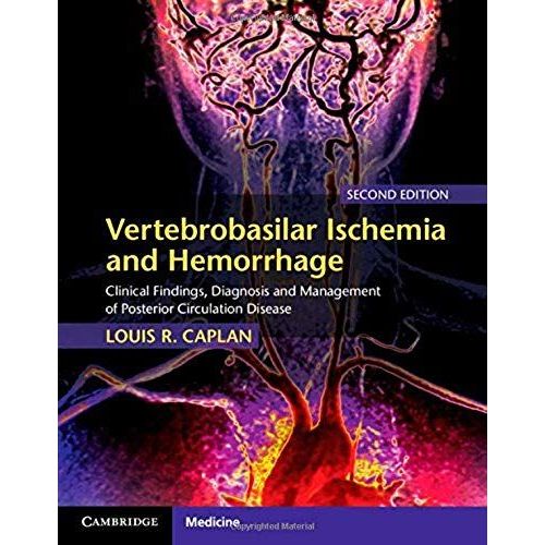 Vertebrobasilar Ischemia and Hemorrhage: Clinical Findings, Diagnosis ...